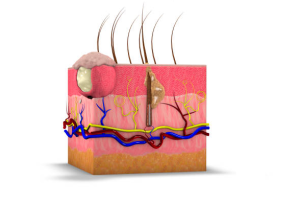 The Complete Guide to Sebaceous Cysts: Symptoms, Causes, Diagnosis, and ...
